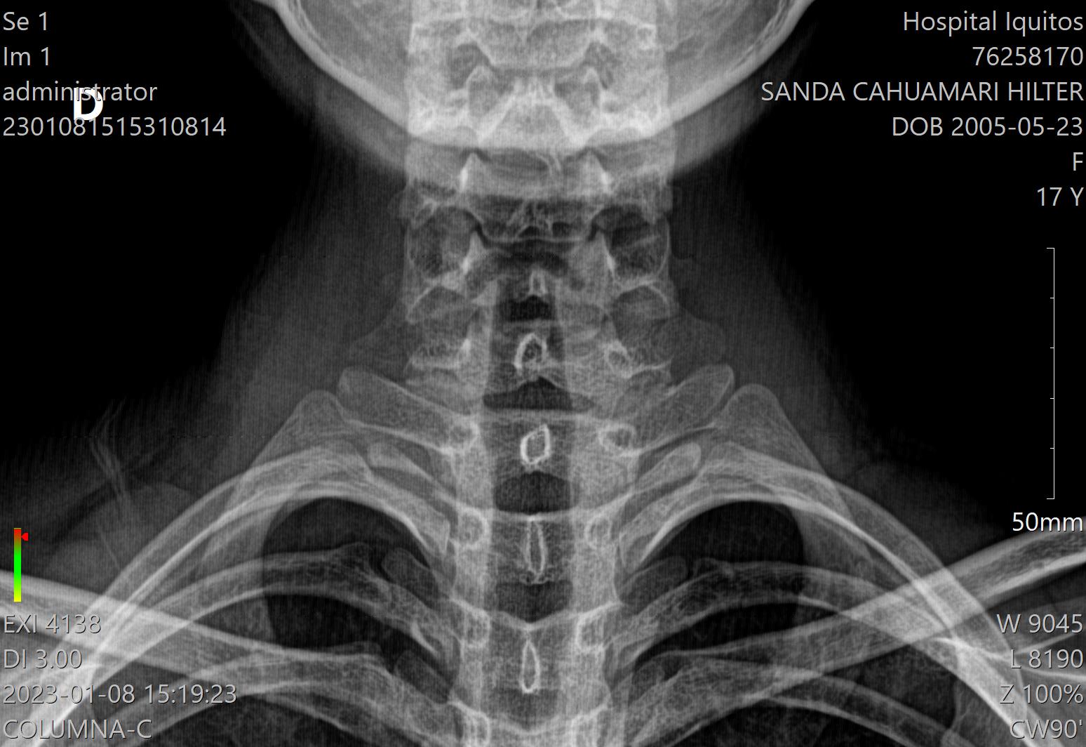 Detalle - placa
