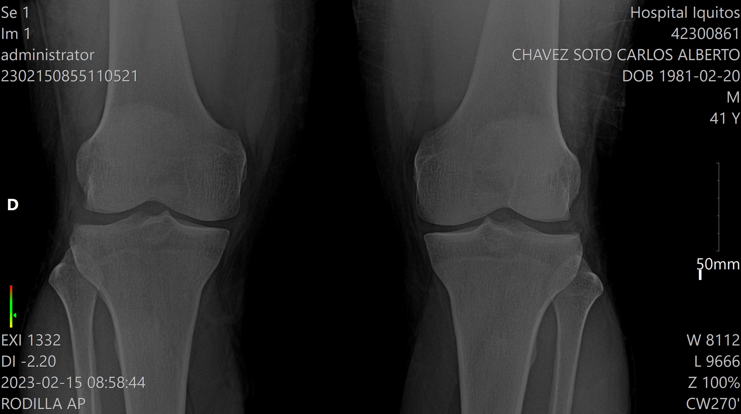 Detalle - placa